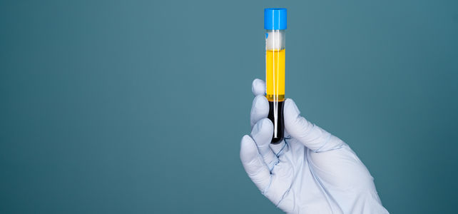 Italy: Hyperimmune plasma study results are published